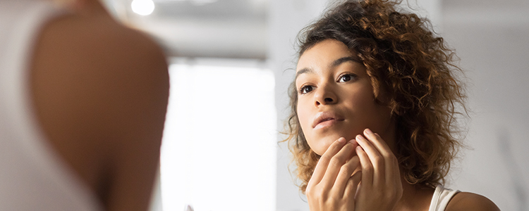 ACNE SCARRING - Dr Ayanda Motau